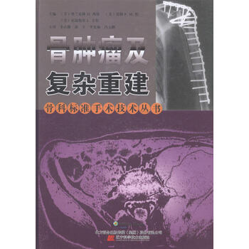 骨及复杂重建 弗兰克林西姆 医学 9787538187021