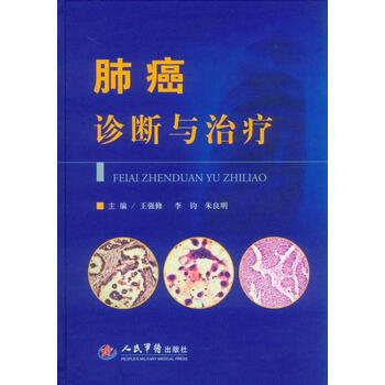 肺癌诊断与治疗