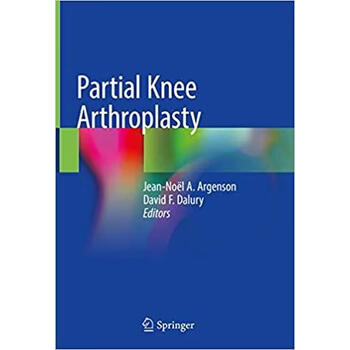 Partial Knee Arthroplasty
