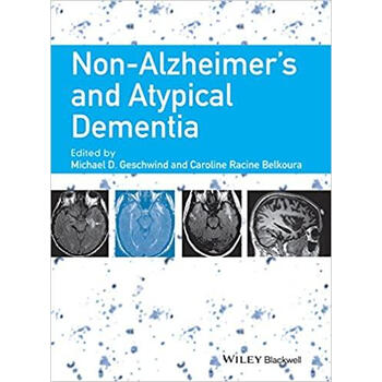 Non-Alzheimer's and Atypical Dementia