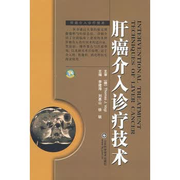 肝癌介入诊疗技术【正版图书】