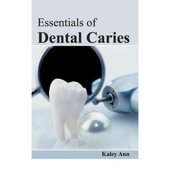 Essentials of Dental Caries
