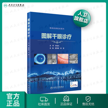 图解干眼诊疗