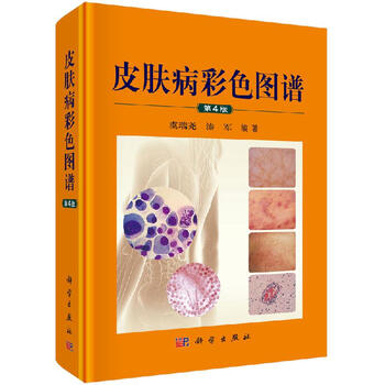 皮肤病彩色图谱/虞瑞尧,漆军/科学出版社
