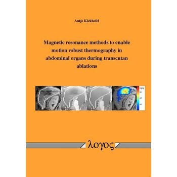 Magnetic Resonance Methods to Enable Motion Robu