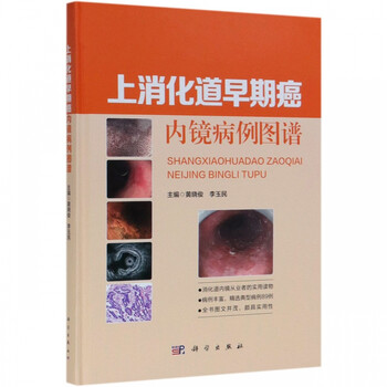 上消化道早期癌内镜病例图谱(精)
