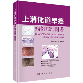 上消化道早癌病例病理图谱/李玉民,黄晓俊