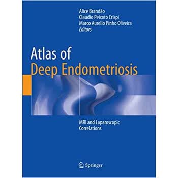 Atlas of Deep Endometriosis: MRI and Laparoscopi