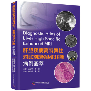 肝胆疾病高特异性对比剂增强MR诊断:病例荟萃