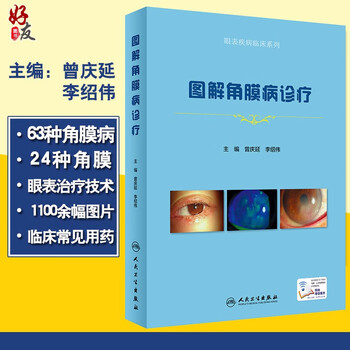 图解角膜病诊疗 眼表疾病临床系列精选1100高清图片角膜病诊疗 曾庆延 李绍伟主编 人民卫生出版社