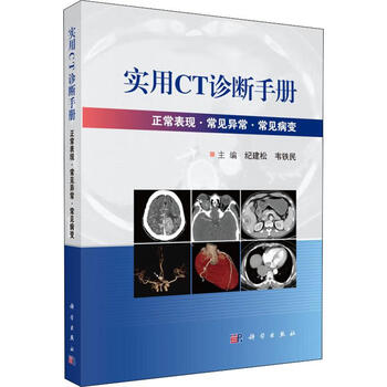 实用CT诊断手册 纪建松,韦铁民 编 书籍