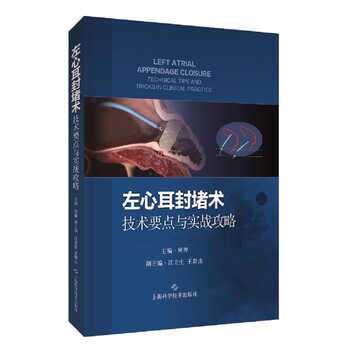 左心耳封堵术：技术要点与实战攻略