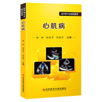 心肌病