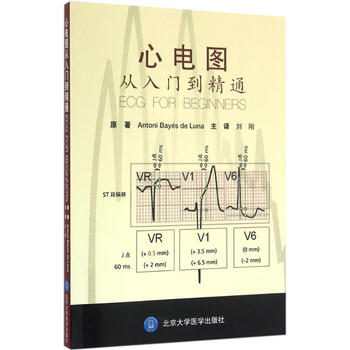 心电图从入门到精通