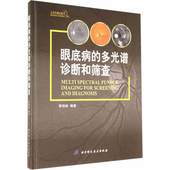 眼底病的多光谱诊断和筛查
