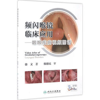 频闪喉镜临床应用