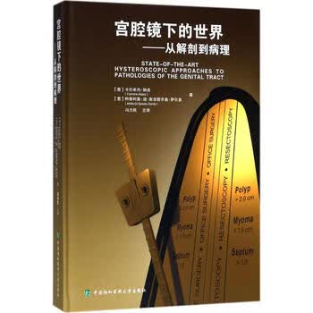 宫腔镜下的世界 书籍