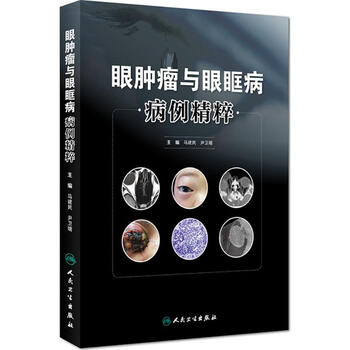 眼肿瘤与眼眶病病例精粹
