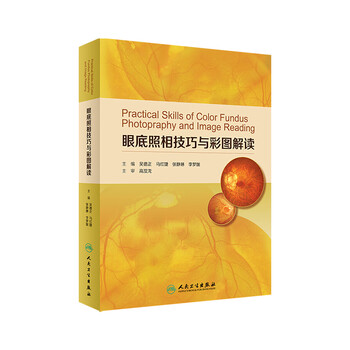 眼底照相技巧与彩图解读