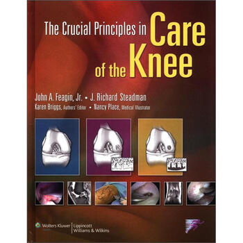 正版图书 TheCrucialPrinciplesinCareoftheKnee JohnA.Fea