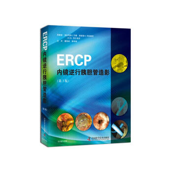 ERCP内镜逆行胰胆管造影 (美)托德·H.巴隆 编 潘阳林,郭学刚 译 书籍