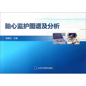 胎心监护图谱及分析