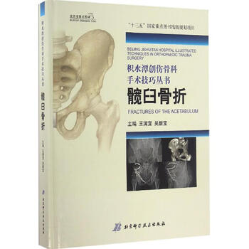 髋臼骨折 王满宜,吴新宝 主编 书籍