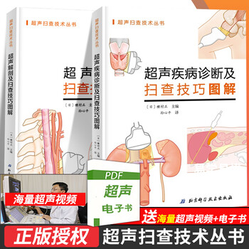 超声疾病诊断及扫查技巧图解+超声解剖及扫查技巧图解书籍正常值测量备忘录技术入门b超血管肌骨心超笔记