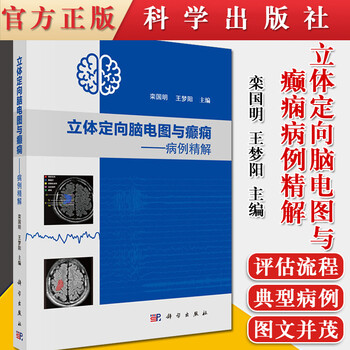 立体定向脑电图与癫痫—病例精解 SEEG评估全部流程中的每个重点环节 SEEG评估