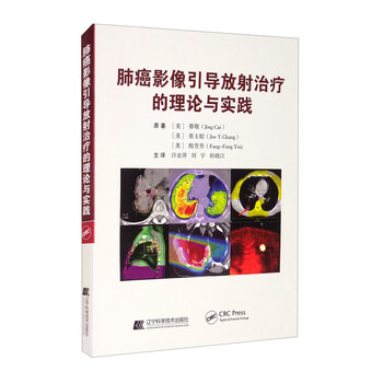 肺癌影像引导放射治疗的理论与实践