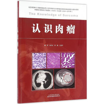认识肉瘤 杨吉龙,杨蕴,王国文 编译 书籍