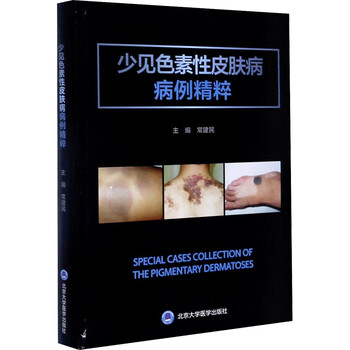少见色素性皮肤病病例精粹 常建民 编 书籍