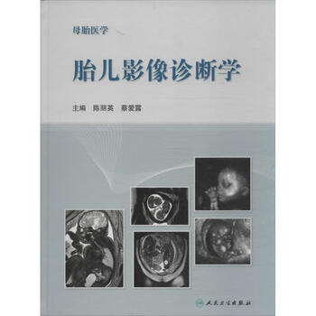 胎儿影像诊断学   书籍