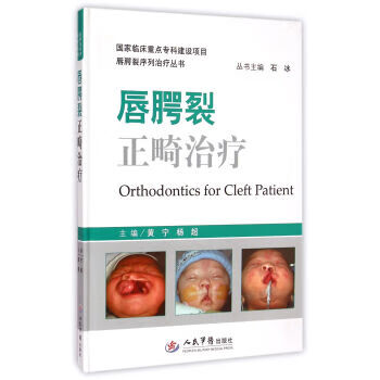 唇腭裂正畸治疗.唇腭裂序列治疗丛书