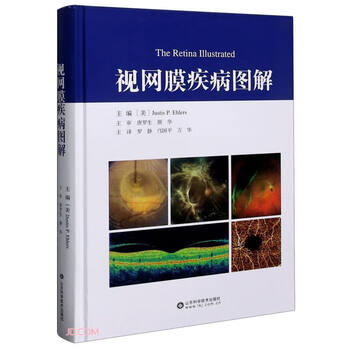 [正版图书]视网膜疾病图解(精)