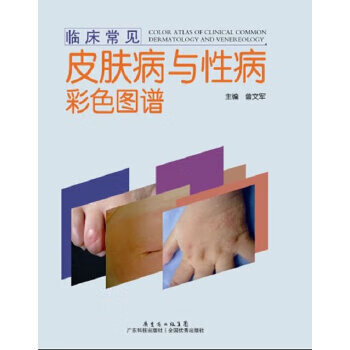 临床常见皮肤病与性病彩色图谱【正版图书】