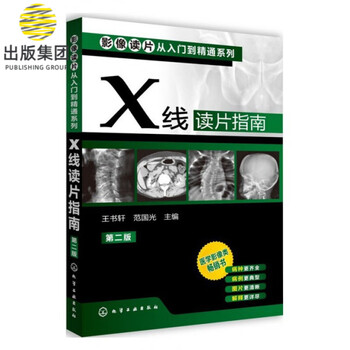 X线读片指南(第2版)/影像读片从入门到精通系列
