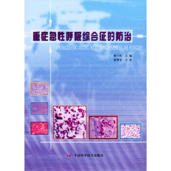 重症急性呼吸综合征的防治