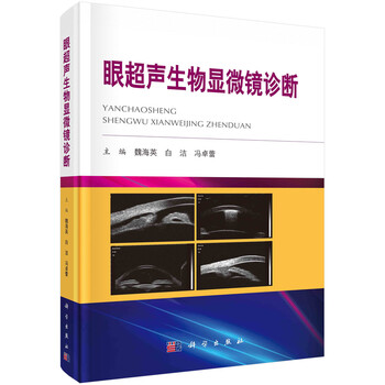 [正版图书]眼超声生物显微镜诊断