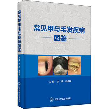 常见甲与毛发疾病图鉴 图书