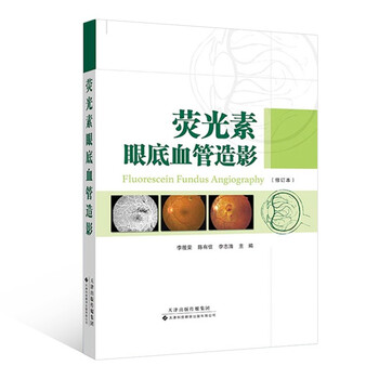 荧光素眼底血管造影