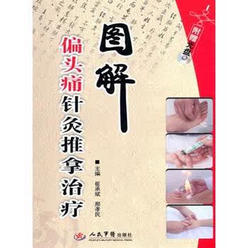 图解偏头痛针灸推拿治疗(附赠光盘)