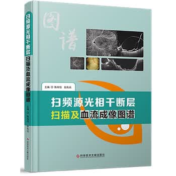 扫频源光相干断层扫描及血流成像图谱(精)