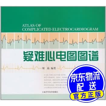 疑难心电图图谱