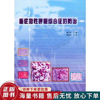 重症急性呼吸综合征的防治