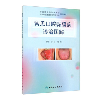 常见口腔黏膜病诊治图解
