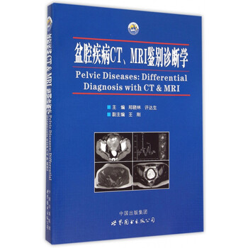 盆腔疾病CT\MRI鉴别诊断学