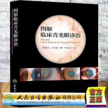 图解临床青光眼诊治