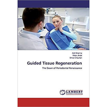 Guided Tissue Regeneration