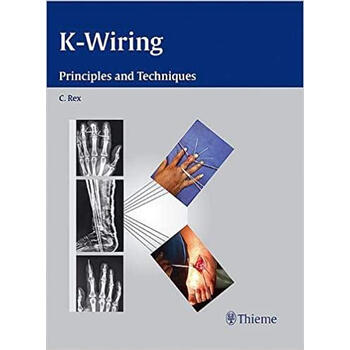 K-Wiring: Principles and Techniques